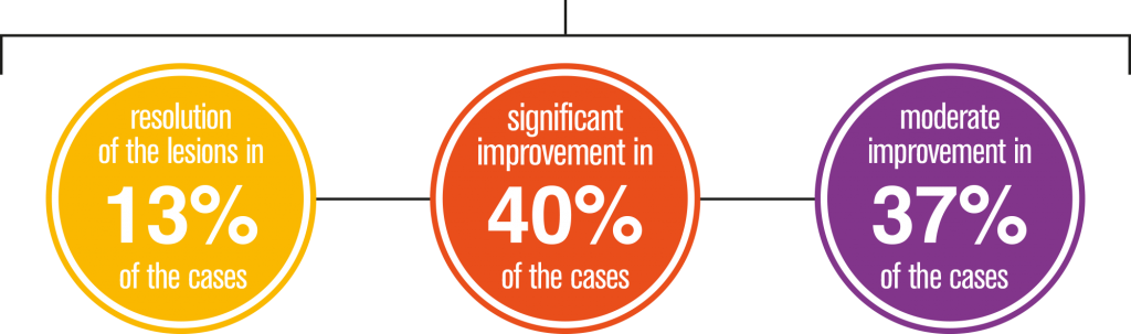 PapiX cleanser – Relife Menarini Group