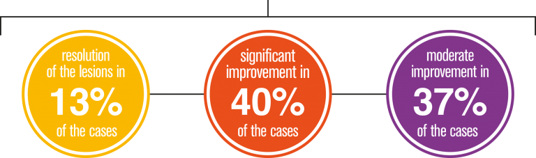 PapiX cleanser – Relife Menarini Group